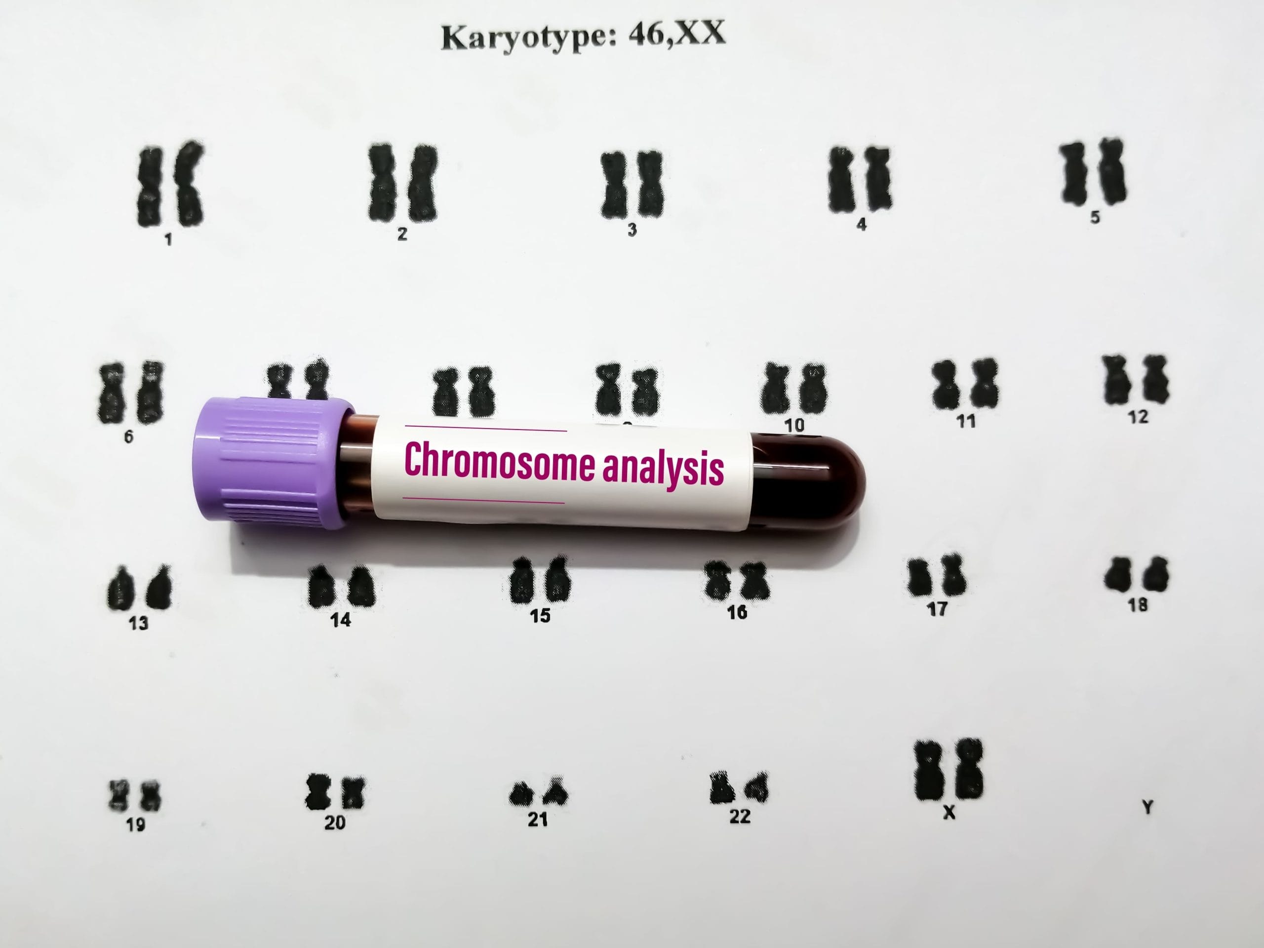 Apa Itu Karyotyping? Fungsi, Prosedur, hingga Pembacaan Hasil